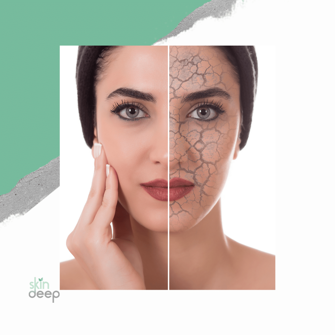 The #1 Ultimate Skincare Routine for Dry Skin - Skin Deep Esthetics LLC The #1 Ultimate Skincare Routine for Dry Skin - Skin Deep Esthetics LLC