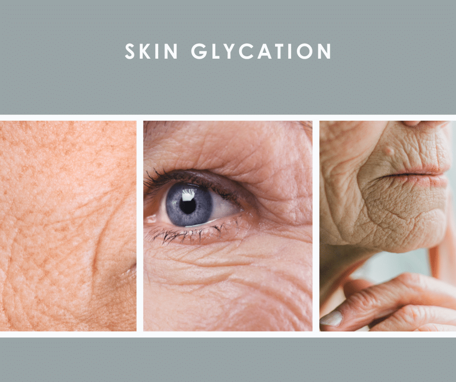 Skin Glycation - Skin Deep Esthetics LLC