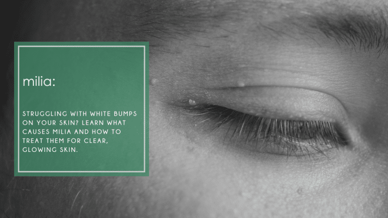 Milia Explained - Skin Deep Esthetics LLC